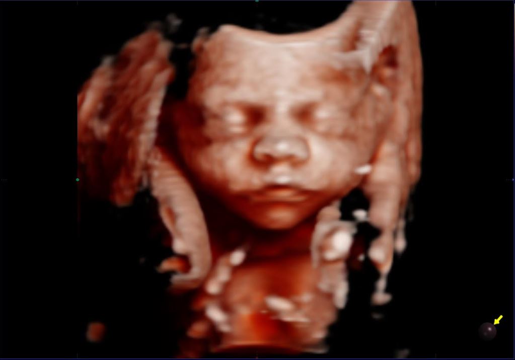 Explorando la belleza del bebé a las 28 semanas de embarazo