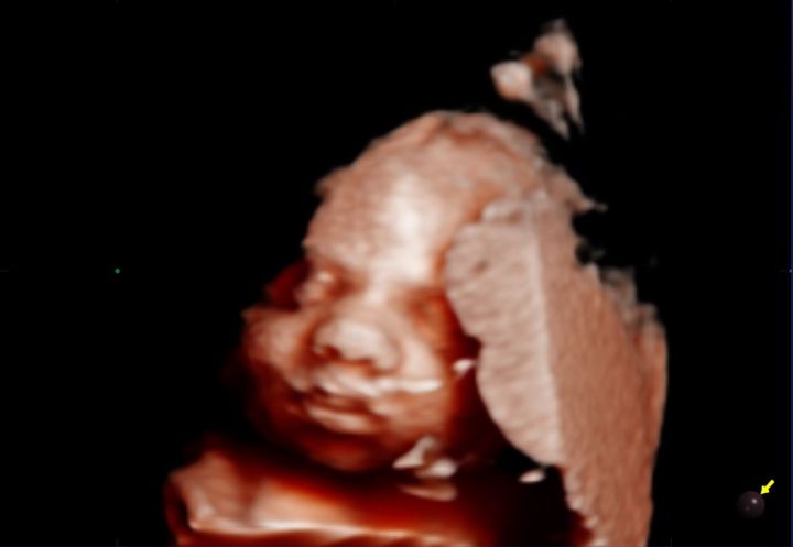 Ecografía Semana 31: Todo lo que necesitas saber sobre el desarrollo fetal